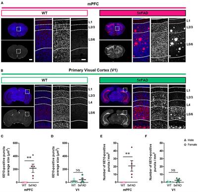 Frontiers | Selective Regional Loss of Cortical Synapses Lacking Presynaptic Mitochondria in the ...
